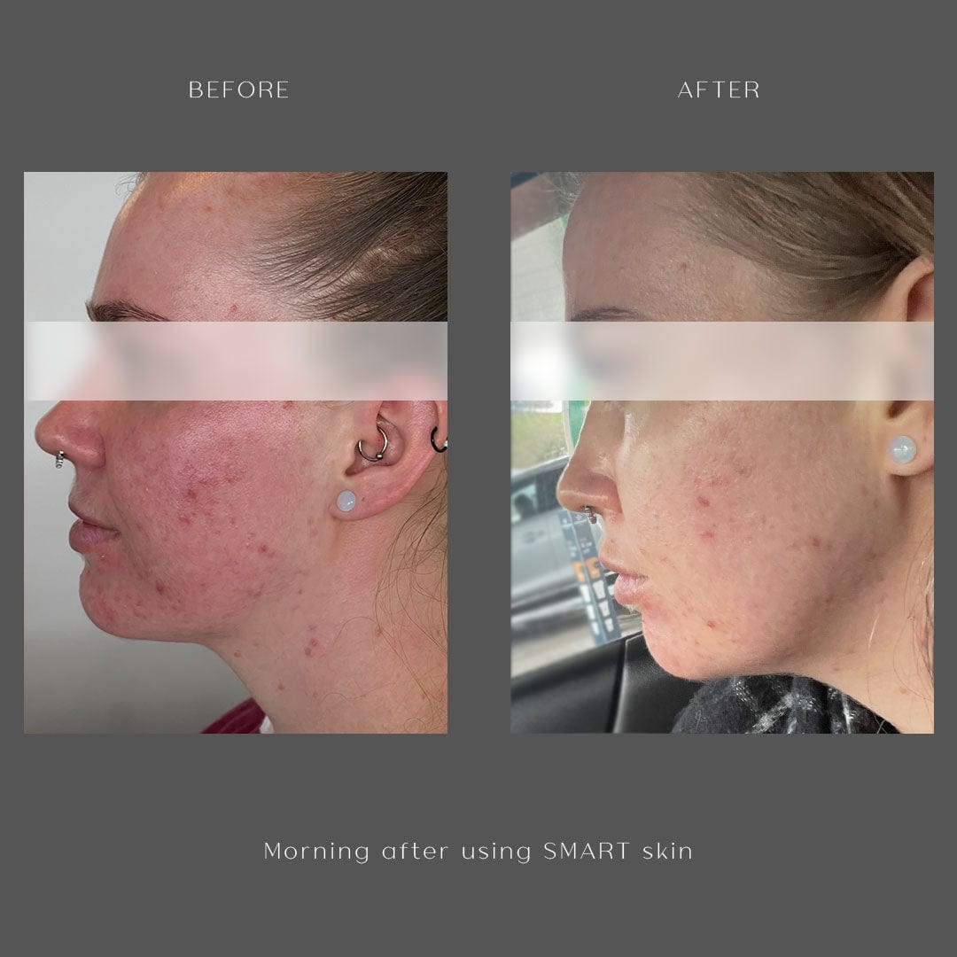 Shop Smart Face Cream 50g Online | Corbin Rd